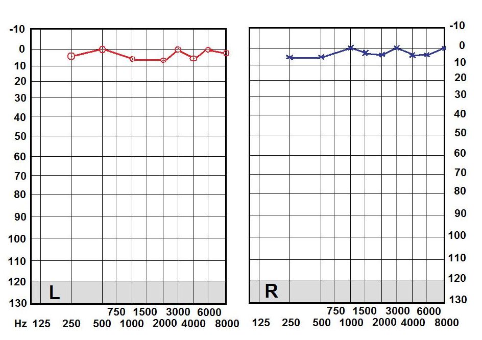 FSG: Pat's Column - January